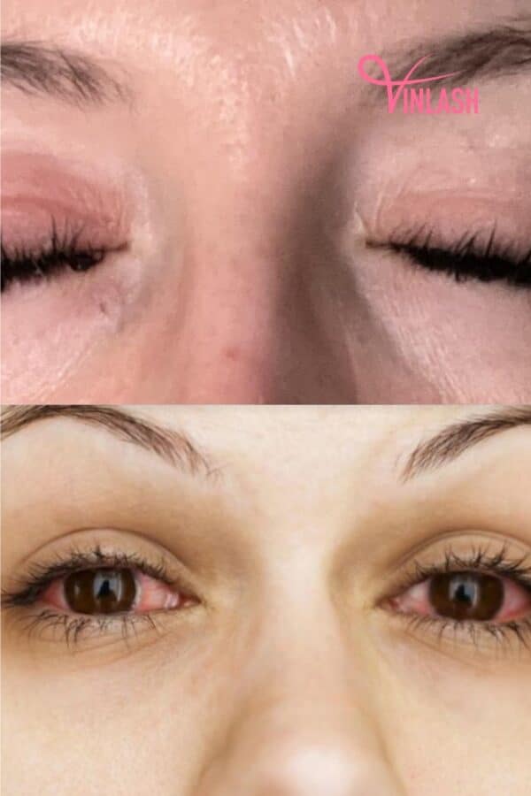 Tips to Prevent and Relieve Itchy Eyelash Extensions
